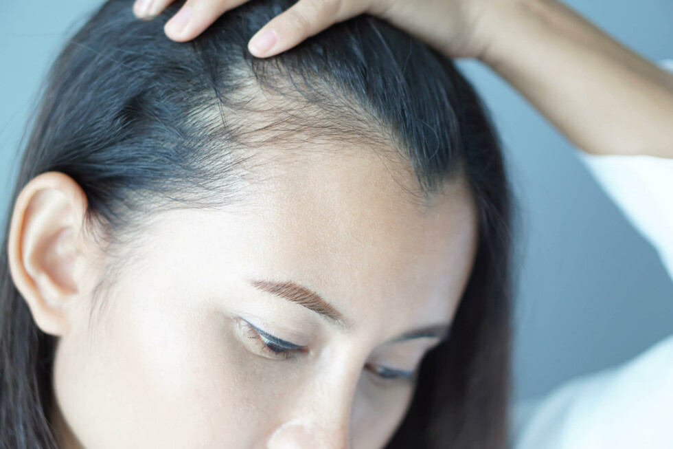 What Are the Causes of Hair Loss in Women - HairScience