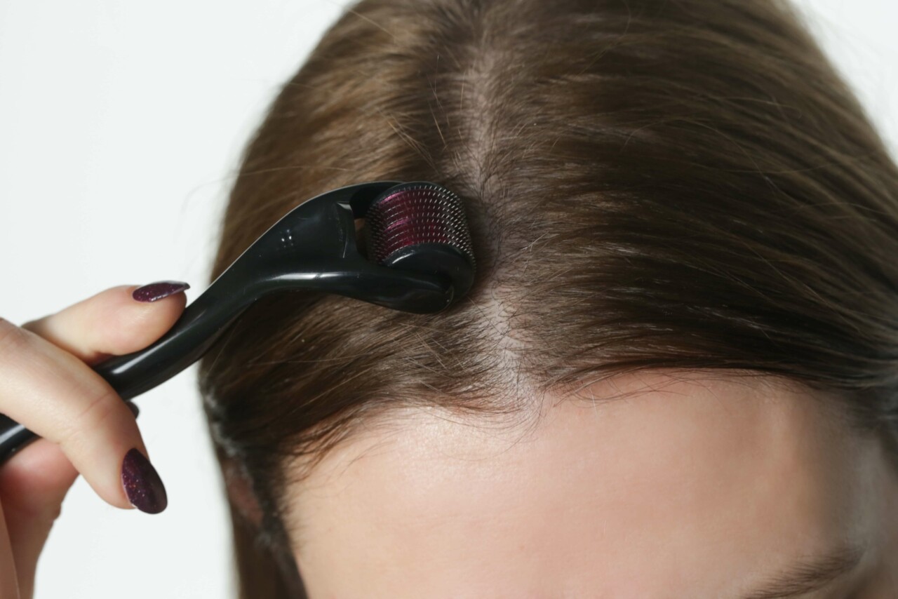Microneedling for hair loss: some real facts about it