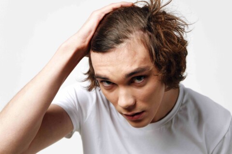Balding at 20? Some signs to recognize it quickly